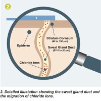 SUDOSCAN Principe - Impeto Medical - SUDOSCAN & EZscan