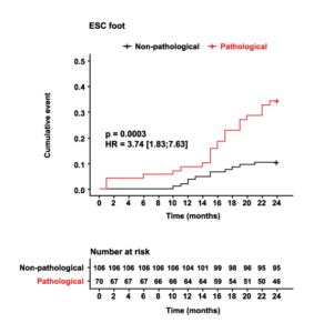 Sudoscan and Cardiovascular outcomes in Hemodialysis - Sudoscan